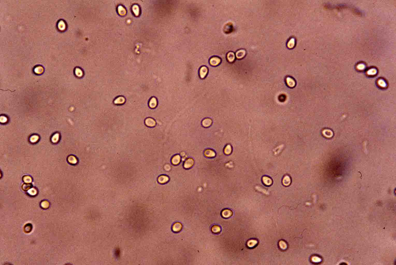 Fig. 3. Fresh spores of Microsporidium seriolae